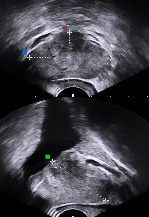 Prostata | Urologie Bamberg